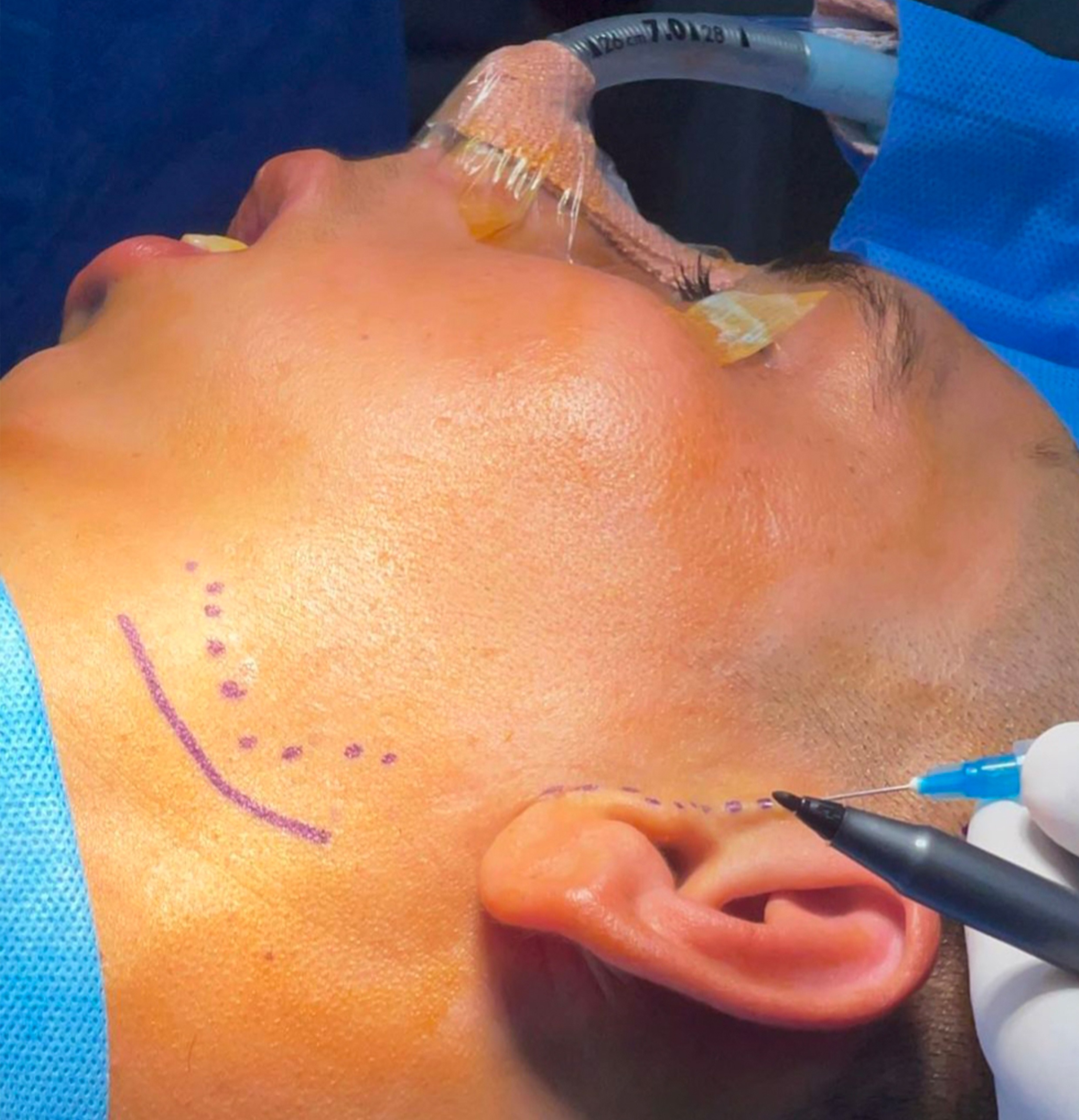 India's No.1 Best TMJ Replacement Hospital In India