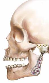 India's No.1 Best TMJ Replacement Hospital In India