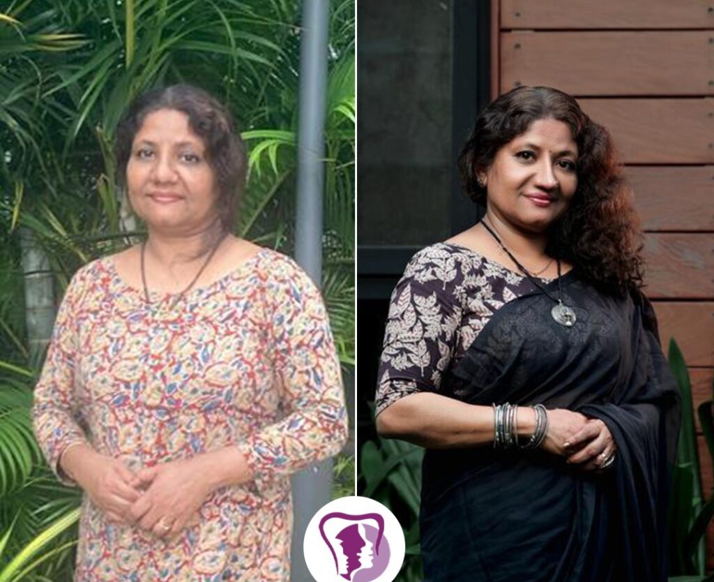 Tip Plasty At India's First Face Hospital | Richardsons Face Hospital